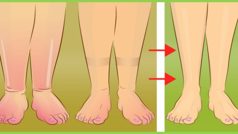 Causes et solutions simples pour vous débarrasser de la rétention d'eau ...